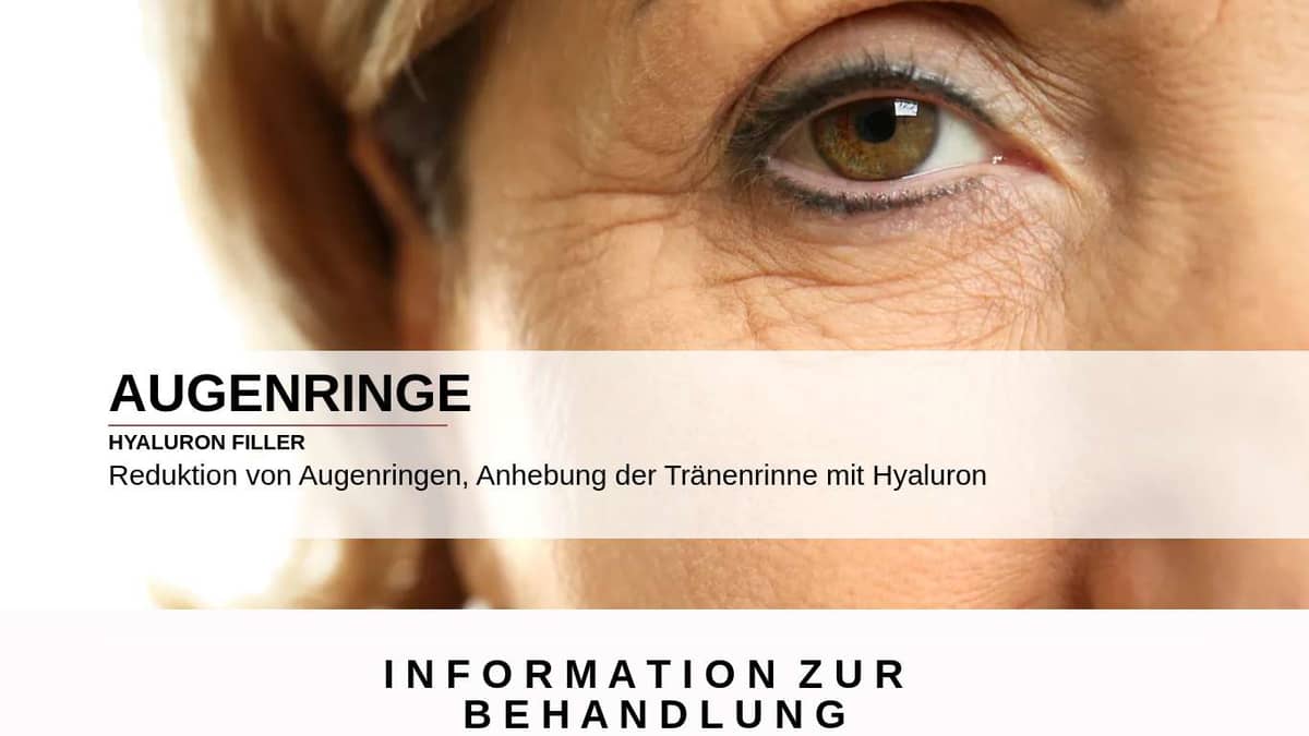 Augenringe entfernen - schnell & effektiv