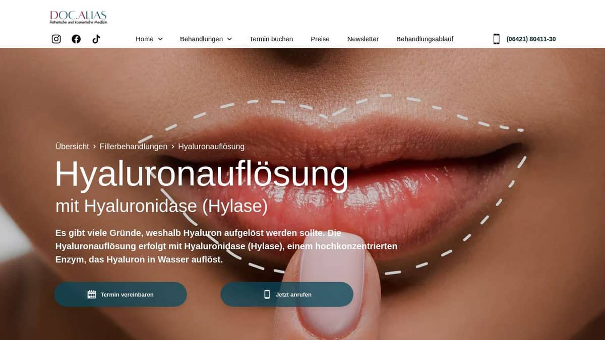 Hyaluron auflösen mit Hylase - bei Knötchen in den Lippen und Assymetrien