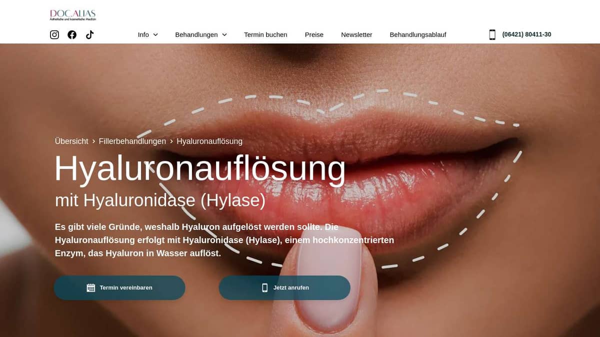 Hyaluron auflösen mit Hylase - bei Knötchen in den Lippen und Assymetrien