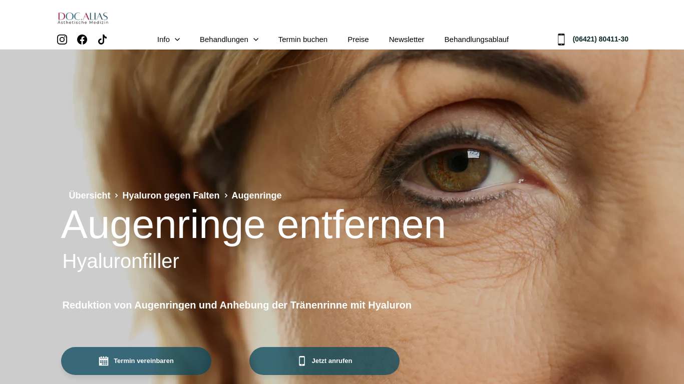 Augenringe entfernen - schnell & effektiv